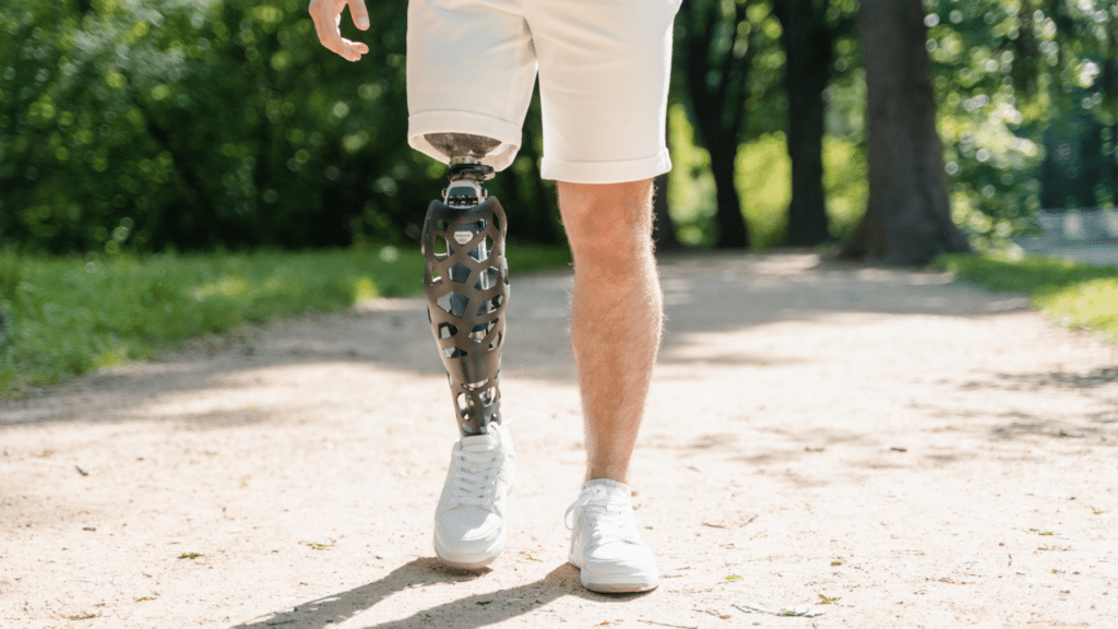 Gallery - Backup Limbs