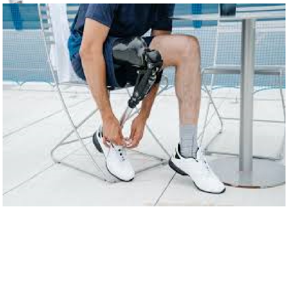 BEST Artificial Limb PROSTHESIS Leg in Mumbai | 9321110091